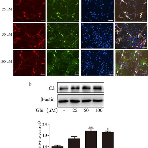 Different Concentrations Of Glutamate Induced Inflammatory Response In Download Scientific