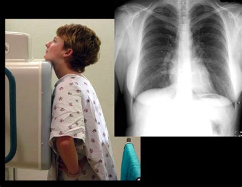 Week 8 Xray Anaesthesia Flashcards Quizlet