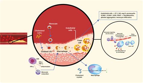 Targeting Inflammation In Atherosclerosis Overview Strategy And