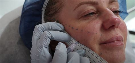 Eyebrow Threading Gone Wrong