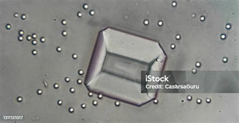 Microscopic View Of Calcium Oxalate And Hippuric Acid Crystals From