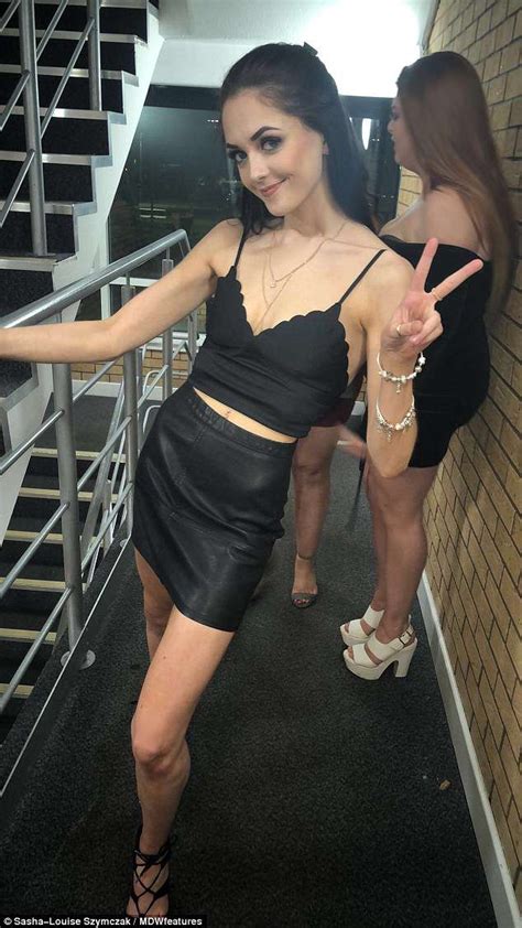 Anorexia Dancer Survived On 300 Calories A Day Daily Mail Online