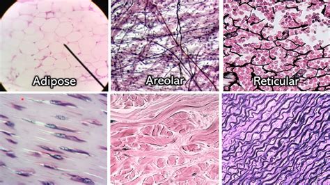 Dense Irregular Connective Tissue Histology Explained Eresources Blog