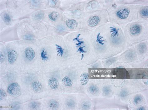 Metaphase Mitosis Microscope