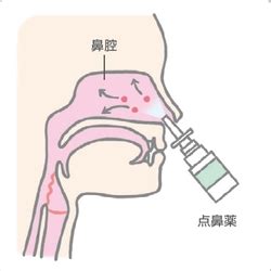 まとめ点鼻薬の分類簡易版 うつ持ち薬剤師の独り言