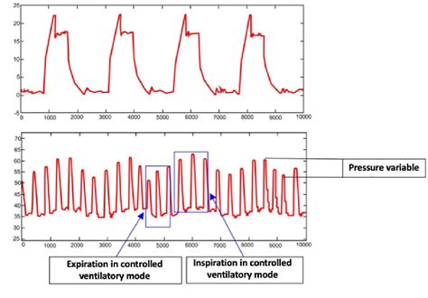 Table 1 From Invasive Minimally Invasive And Non Invasive Hemodynamic Monitoring In