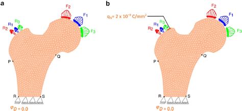 A Meshed Finite Element Model Of The Proximal Femur With Applied