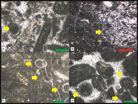 Lower Ordovician Calcareous Microfossils From The San Juan Formation Argentina A New Type Of