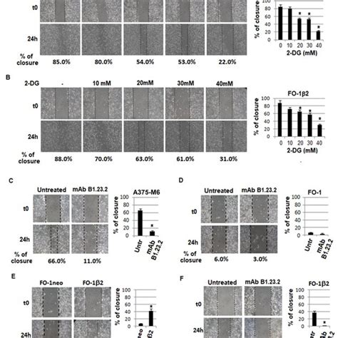 Hla Class I And Ii Antigen Expression On Melanoma Cells A375 M6 Left