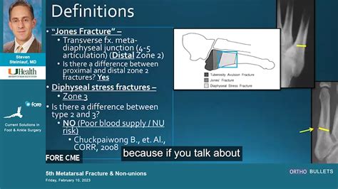 Jones Fracture Orthobullets