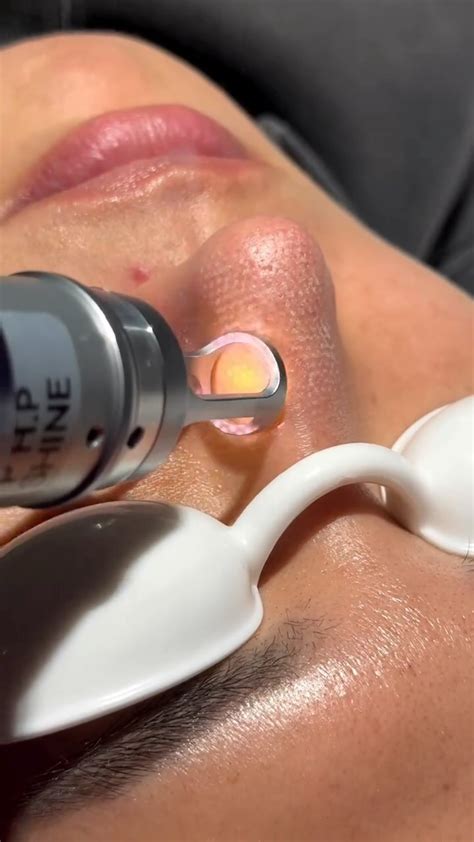 문정원 25년 공격적으로 달린다 했죠ㅎㅎ 날짜 보이시나요 1년 전부터 전지점 원장진들과 열심히 테스트하며 준비해 온 피부 고민별 심층 타겟 프로그램 세분화 전략