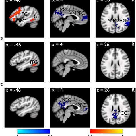 Brain Regions Related To The Subsequent Memory Effect A Brain Download Scientific Diagram