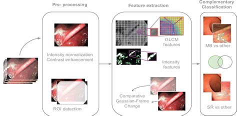 Figure 1 From Automatic Method For Detecting Specular Reflection And Motion Blur Artifacts On