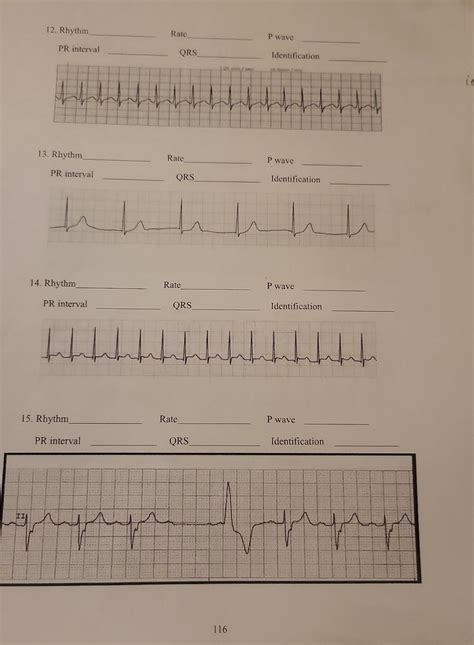 Solved 12 Rhythm Rate P Wave Pr Interval Qrs Identification
