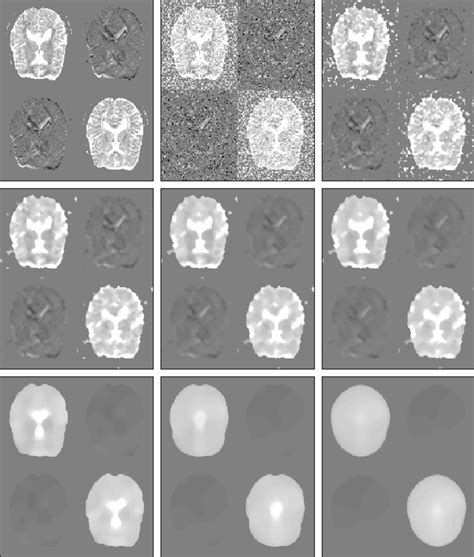 Matrix Valued Median Filtering Applied To A 2d Dt Mri Frame A Top