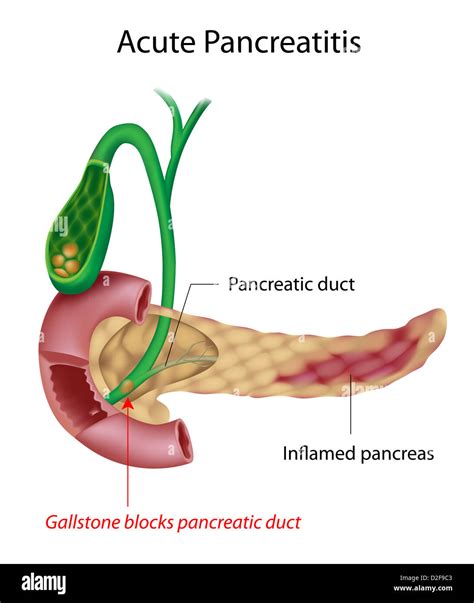 Rawhide And Pancreatitis At Jamie Crow Blog