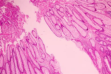 10 000 เนื้อเยื่อบุผิว เนื้อเยื่อ ภาพถ่ายสต็อก รูปภาพ และภาพปลอดค่าลิขสิทธิ์ Istock