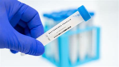 Bacteroides Fragilis Stock Image Image Of Biochemistry 352793305