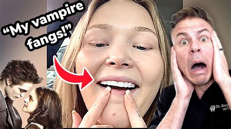 Vampire Fangs Twilight