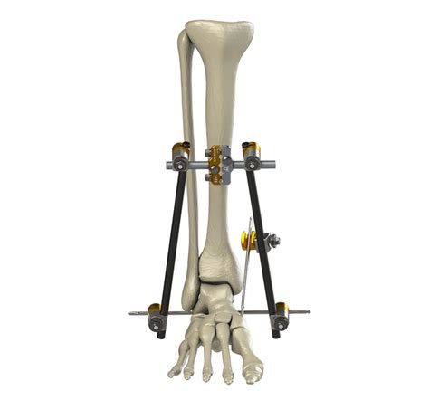 Journal Of Orthopaedic Experience Innovation The Clinical And