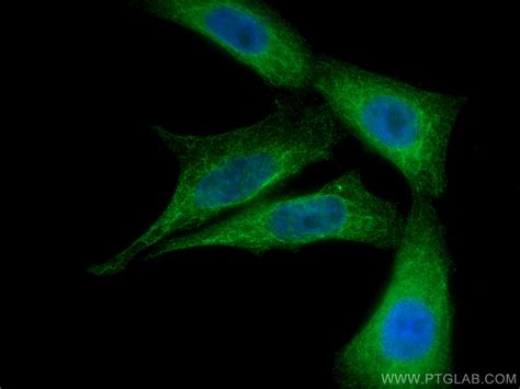 Sgk1 Antibody 28454 1 Ap Proteintech
