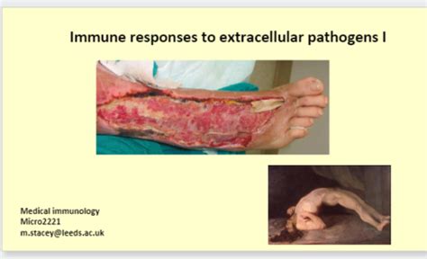 Lec 6 Immune Response To Extracellular Paths 1 Flashcards Quizlet