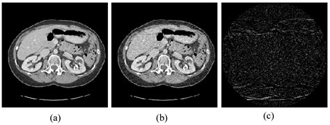 Sparse View Computed Tomography Reconstruction Based On A Novel