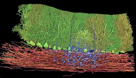 A New Field Of Neuroscience Aims To Map Connections In The Brain