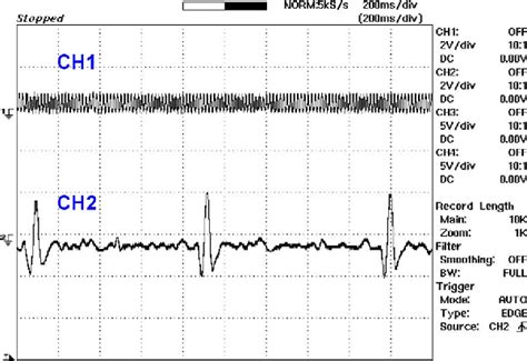 figure 11 from hardware implementation of emd using dsp and fpga for online signal processing