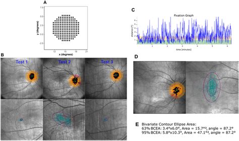 Healthy Control Example A Custom Point Grid Pattern With Download Scientific