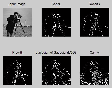 Image Processing Using Matlab Edge Detection