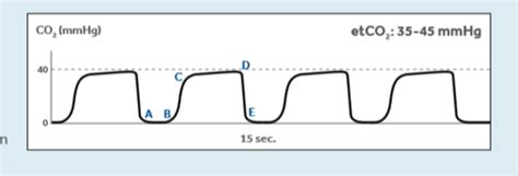 Capnogram Emt Flashcards Flashcards Quizlet
