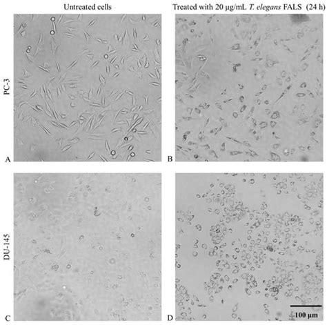 Fermentation Special Issue Fermentation 10th Anniversary