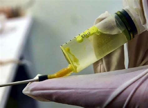 H2s Sampling Into 1n Cd No3 2 Solution Using A Plastic Medical Syringe