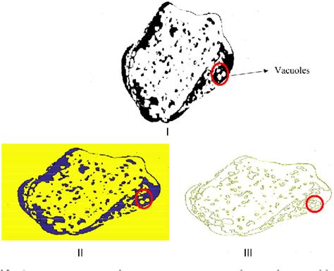 figure 10 from improved image segmentation algorithms for detecting types of acute lymphatic
