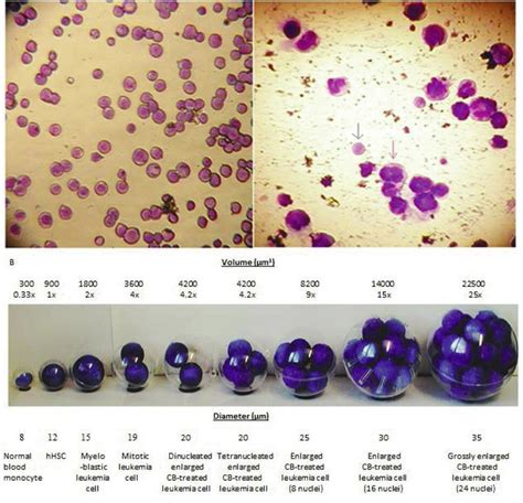 Comparison Of U937 Cells After Treatment With Cytochalasin B A Download Scientific Diagram