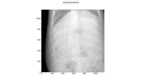 Unexpected Drr Orientation · Issue 99 · Arcadelabdeepdrr · Github