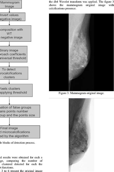 figure 3 from detection of microcalcifications in digital mammograms