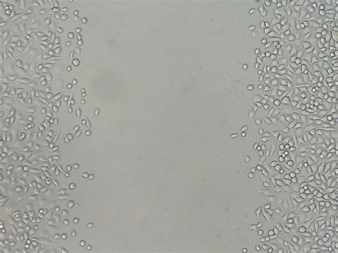 细胞划痕实验和transwell实验，究竟有什么区别？ 知乎