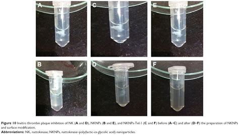 Development Of Surface Engineered Plga Nanoparticulate Delivery System Ijn