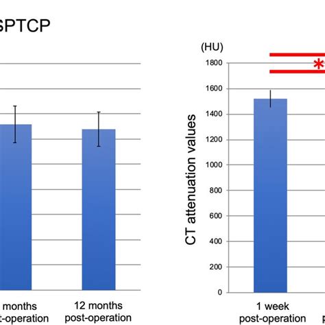 Ct Attenuation Values Hu For Udptcp And Spherical Porous β Tricalcium