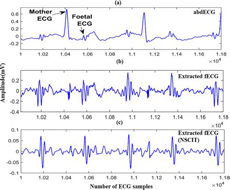 simulated results of record e771 of db2 a mother abdominal ecg