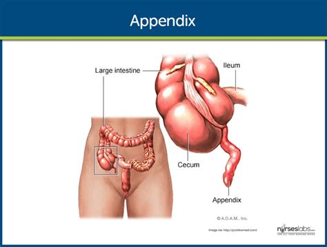 Appendicitis Nursing Care Management Study Guide