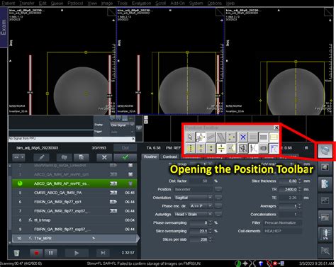 Position Toolbar Usage On The Prisma Cfmri Siemens Prisma