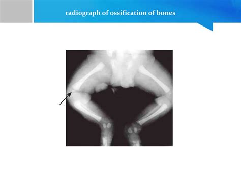 Skeletal System And Its Mobility And Function Ppt