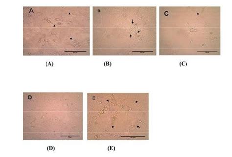 In Vitro Growth Of Bm Mscs Cells Were Photographed With Phase Contrast