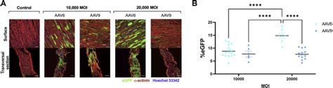 Living Myocardial Slices For The Study Of Nucleic Acid Based Therapies PMC