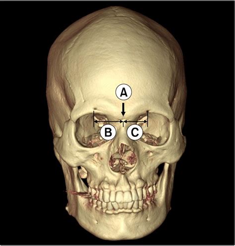 Measurement Methods For The Three Dimensional Computed Tomography Download Scientific Diagram