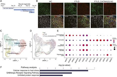 Finding A New Drug Target To Treat Frontotemporal Lobar Degeneration