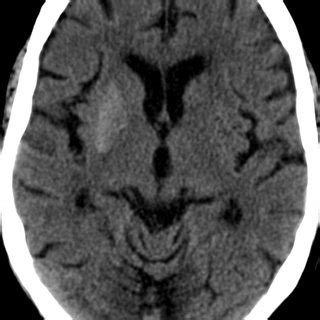 Example Images With Question Answer Pairs In The VQA Med Task Download Scientific Diagram